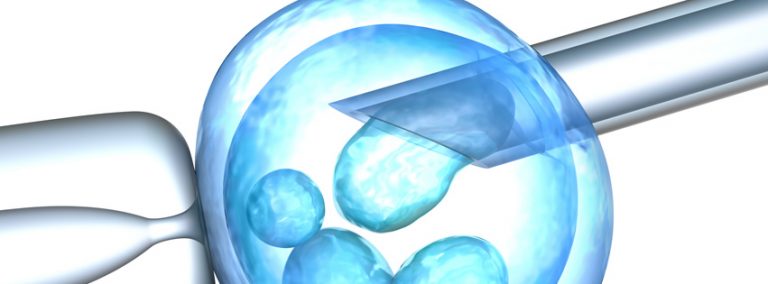 Preimplantation Genetic Screening Pgs Pgd Westchester Fertility Ivf